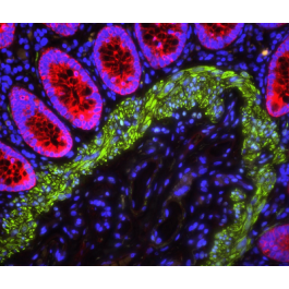 VECTASHIELD PLUS Mounting Medium with DAPI - AdipoGen Life Sciences ...