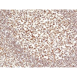 anti-INI1, Rabbit Monoclonal (RM468) - AdipoGen Life Sciences - RevMAb ...