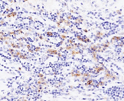 anti-BCMA (human), Rabbit Monoclonal (RM526)-单抗-深圳欣博盛生物科技有限公司